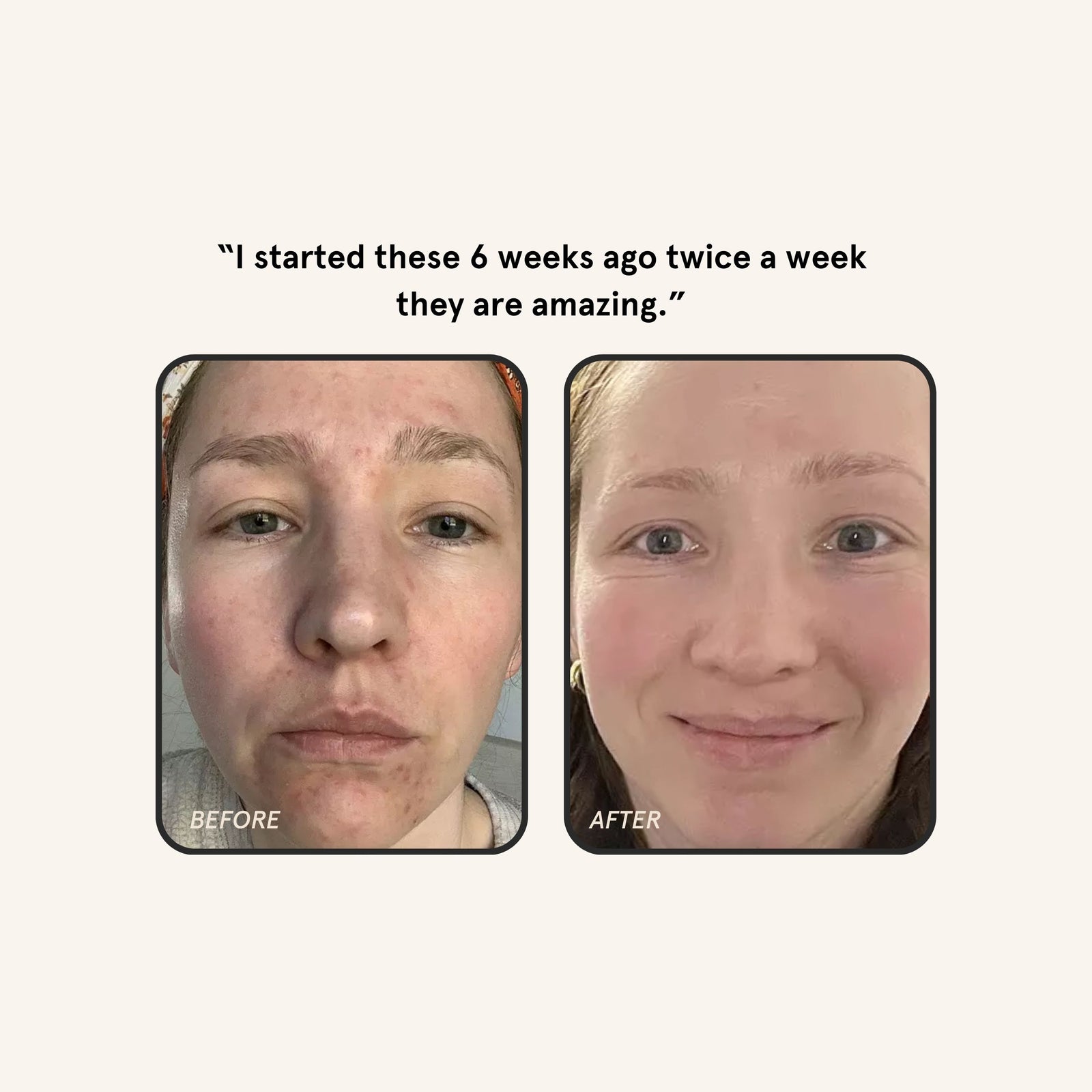 Barefaced® Toning Pads | Barefaced®
